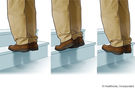 Easy Stretching Exercises for Plantar Fasciitis - Feetcure